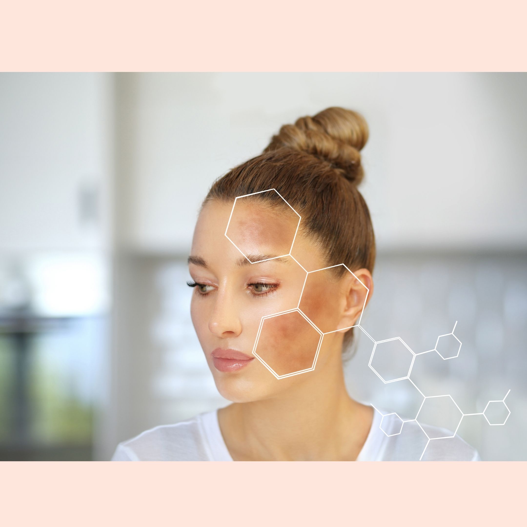 Beauty By Dr. Kay | How to Use Hydroquinone for Hyperpigmentation